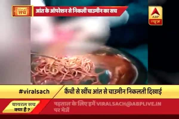 Viral Sach: Are noodles being pulled out of intestines via operation?